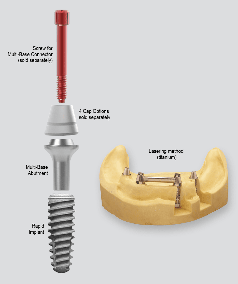 Predictability - Complete Dental Implant Solutions