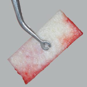 Dermis - Complete Dental Implant Solutions